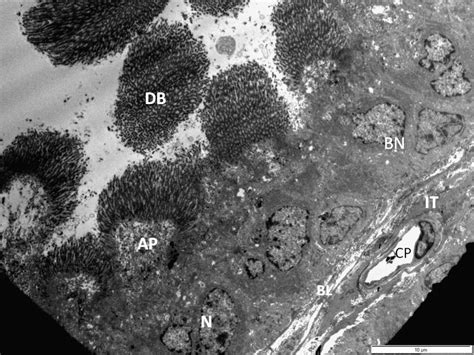 Electron Micrograph Of The Epithelium Of The Seminal Vesicular Gland Of