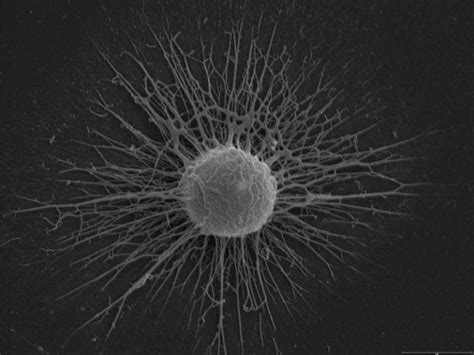 Cryptococcus Neoformans Scheda Micologica Ed Approfondimenti