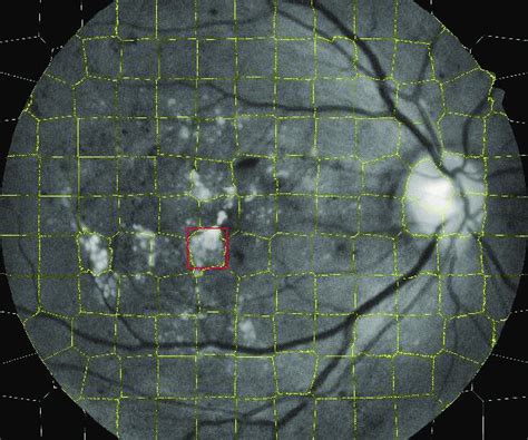 Slic Superpixel Segmentation Result With Region Number Of 150 And Download Scientific Diagram