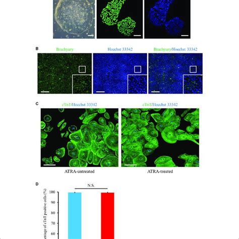 Differentiation Of Ipsc Into Three Germ Layers Formation Of Embryoid