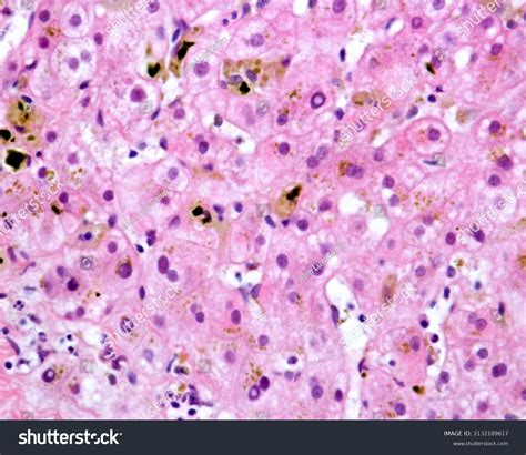 Liver Histology Kupffer Cells