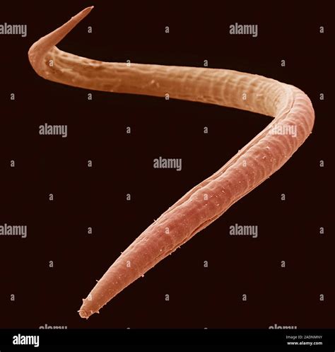 Freshwater Nematode Worm Coloured Scanning Electron Micrograph Sem This Is A Free Living