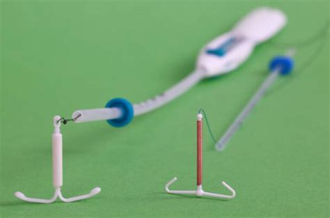 Coil Contraception Everything You Need To Know Welzo Welzo