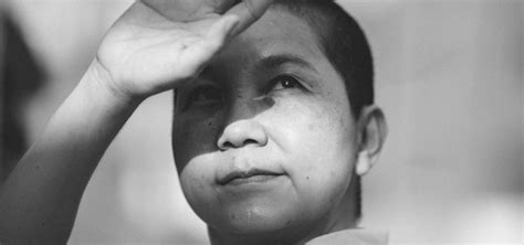 Melasma Vs Hyperpigmentation Know The Difference Pynocare PH