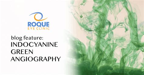 Indocyanine Green Angiography Roque Eye Clinic Ph