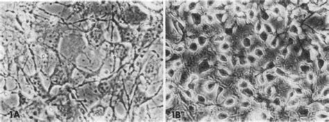 a phase contrast photomicrograph of cloned ms cells maintained in download scientific diagram