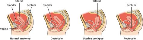 63 Structural Disorders Medicine Libretexts
