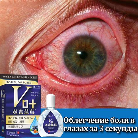 Капли для глаз купить на Ozon по низкой цене 1914420740