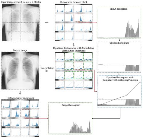 Real Time Clahe Algorithm Implementation In Soc Fpga Device For 4k Uhd