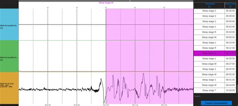 Sleep Stage Classification With Multi Scale Multi Period CNN Do Tri Nhan