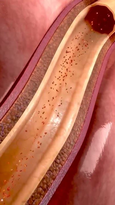 ¿qué RelaciÓn Tiene La Electricidad Con El CorazÓn CardiÓloga De