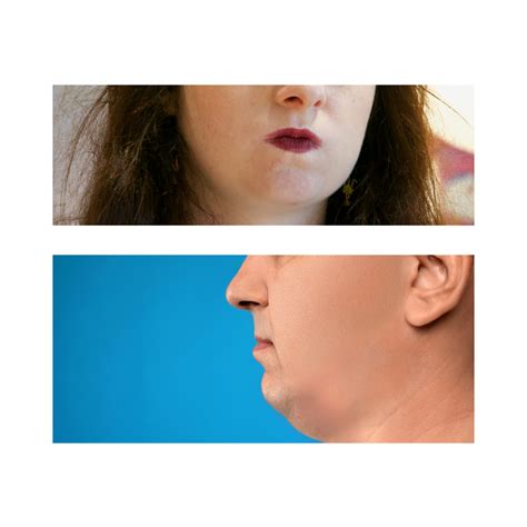 How To Get Rid Of My Double Chin — Scrub Me™ Is Here To Guide You On