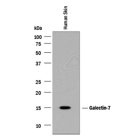 Galectin 7 Polyclonal Antibody Invitrogen 100 μg Unconjugated