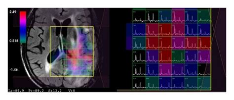 Multidimensional Mrsi Data Visualization A 4d Brain Mrsi Data In