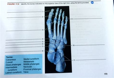 Figure 17 9 Identify The Bones Indicated On This Superior View Of The Right Foot Using The