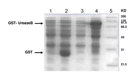 Sds Page Analysis Of Expression Of Pgex 4t 1urease B In E Coli 1
