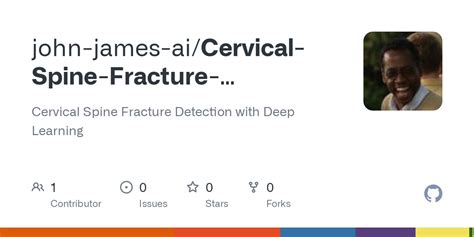 Cervical Spine Fracture Detection De Workspace At Master · John