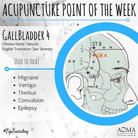 Pin On Acupuncture Treatment