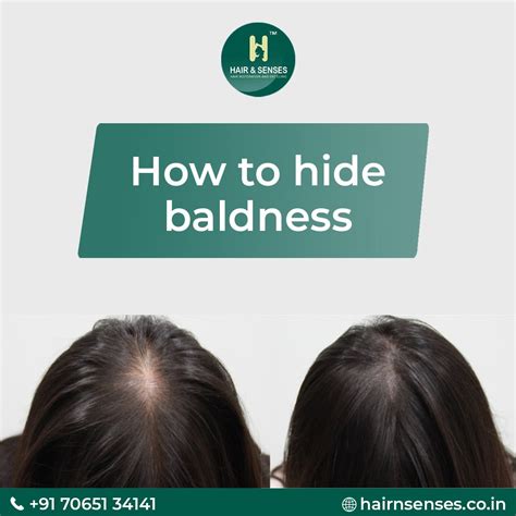 How To Hide Baldness