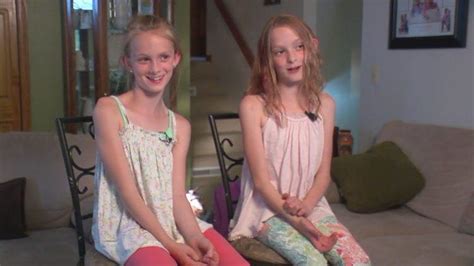 These Conjoined Twins Celebrated 10 Years Apart Tiphero