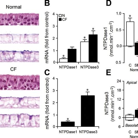 Chronic Infection Amplifies The Effects Of The Cf Genetic Defect And Download Scientific