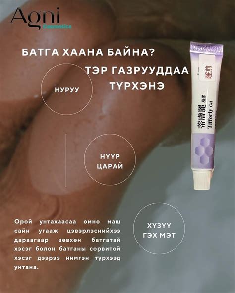 Agni Cosmetics 🌟БАТГАНУУД МИНЬ БАЯРТАЙ😃 Идээт үрэвсэл батга болон батганы сорив нүхжилтийн