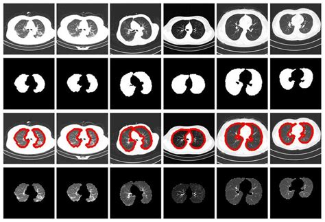 An Example Of The Segmented Image Set Predicted By The Trained