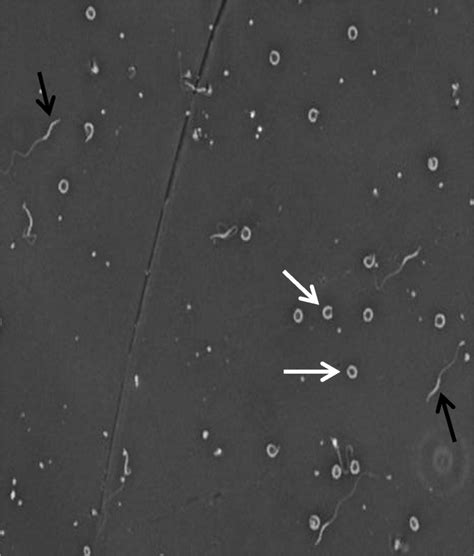 Ostrich Sperm Under Hypo Osmotic Stress ‘round Shapes Are The Swollen Download High