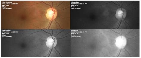 In Situ Hydration Of Co 2 Solvated In The Seawater A Different Efficient And Ecofriendly