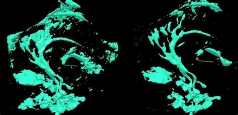 3d Model Of Vessels Created With A The Iterative Histogram Based