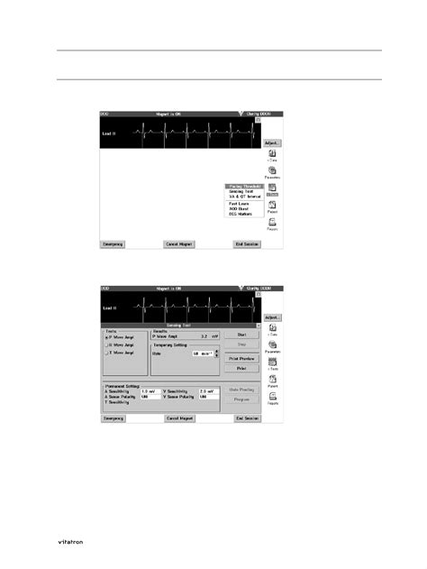 Medtronic 2090 Programming Guide