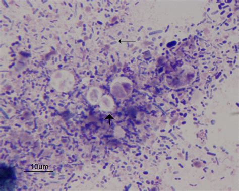 Giardia Cyst In Fecal Float