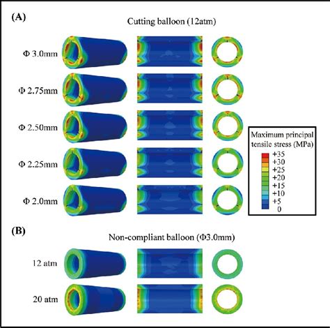 Figure 1 From Finite Element Analysis Of The Cutting Balloon With An Adequate Balloon To Artery