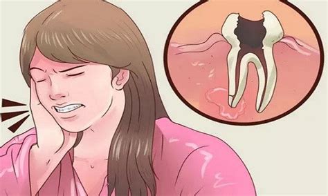 როგორ მოვიშოროთ კბილის ტკივილი ყველაზე მარტივი საშუალებებით სასარგებლო რჩევები