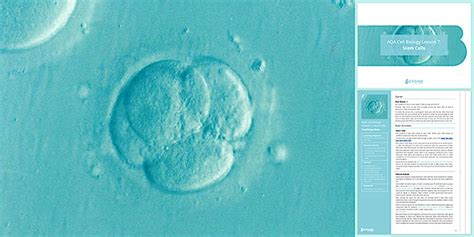 Aqa Gcse Cell Biology Lesson 7 Stem Cells Beyond Twinkl