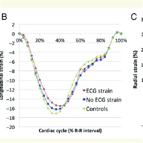 Graphs Of A Mean Circumferential Strain Of The Mid Myocardium B Download Scientific