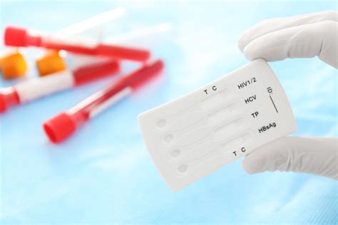 BLOCKS Offers A Package Of Tests For Sexually Transmitted Diseases On World AIDS Day Blocks