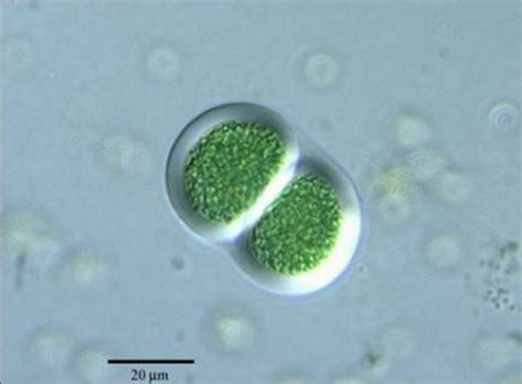 Guangyu Presents To You “the Environmental Barometer” Chroococcus