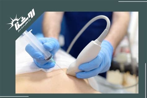 بهترین راه تشخیص سرطان غدد لنفاوی چیست؟ آنچه باید بدانید