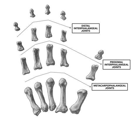 Intermetacarpal Joint