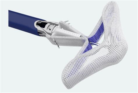 The Pascal Precision System Edwards Lifesciences