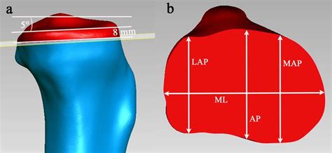 Proximal Tibia Resection And Measurement On Ct Images A Resection Download Scientific Diagram