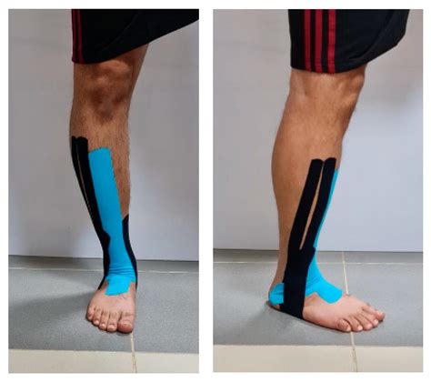 Ankle Taping Effect Of Taping On Actual And Perceived Dynamic Postural