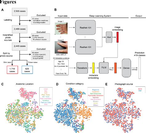 Closing The Ai Generalization Gap By Adjusting For Dermatology Condition Distribution