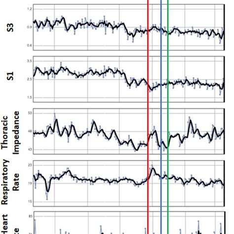Upper Panel Flowchart Depicting The Adjudication Of Heartlogic Alerts