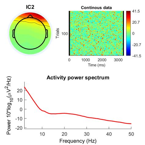 Example Of A Typical Blink Component Removed From The Eeg Scroll Download Scientific Diagram Example Of A Typical Blink Component Removed From The Eeg Scroll Download Scientific Diagram