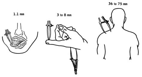 Weber Two Point Discrimination Test Mobile Physiotherapy Clinic