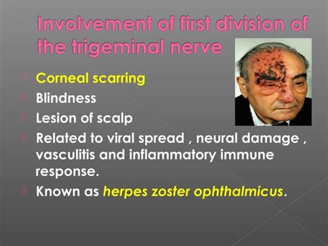 Trigeminal Nerve Max And Opthalmic Div Ppt