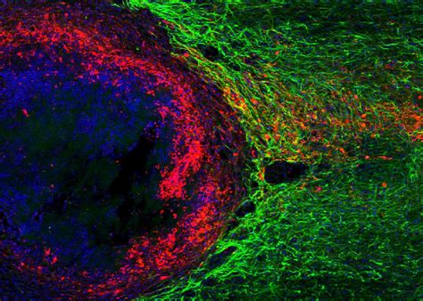Adriana Suarez Gonzalez On Linkedin When Single Cell Meets Spatial Researchers Uncover How