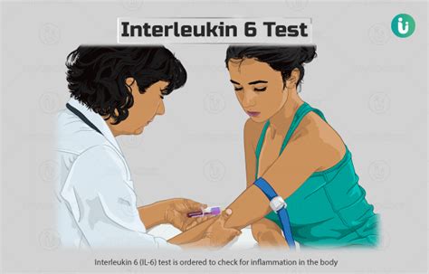 Interleukin 6 Il 6 Test Procedure Purpose Results Normal Range Cost Price Online Booking